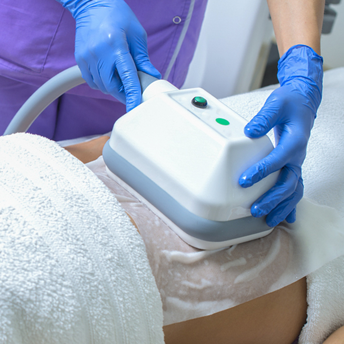 Dermamelan Treatment – Effective Solution for Pigmentation, Melasma ...