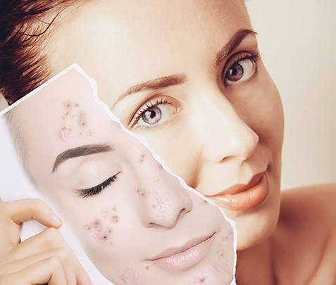 DÉESSE Pro LED Face Mask – Advanced Light Therapy for Anti-Aging & Acne ...