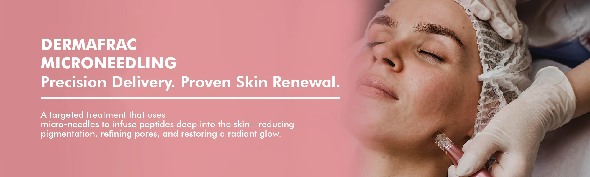 Dermafrac Microneedling Treatment for Instant glow - Isaac Luxe